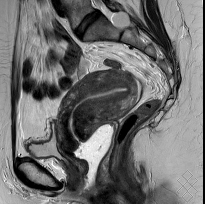 IRM Pelvienne - Définition & Déroulement - Prise de rdv en ligne