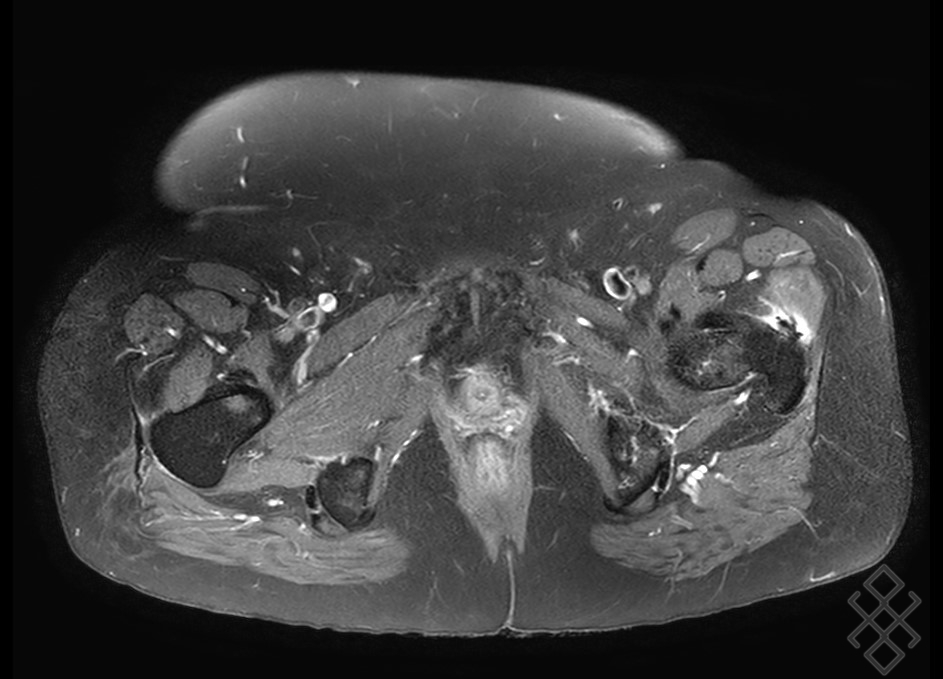 IRM du Bassin - Définition & Déroulement - Prise de rdv en ligne