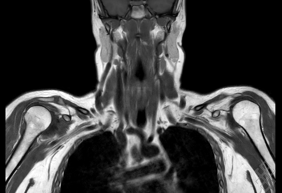 IRM Thoracique - Définition & Déroulement - Prise de rdv en ligne