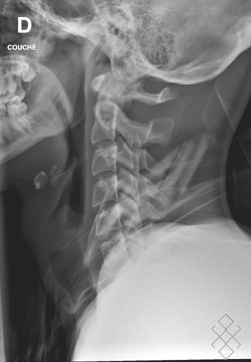 Radiographie du Cavum - Définition & Déroulement - Prise de rdv en ligne