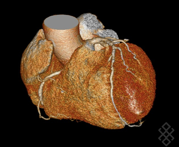Scanner Cardiaque - Définition & Déroulement - Prise de rdv en ligne
