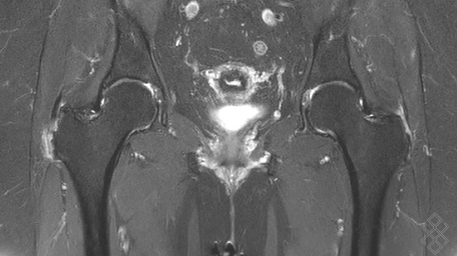 IRM du Bassin - Définition & Déroulement - Prise de rdv en ligne