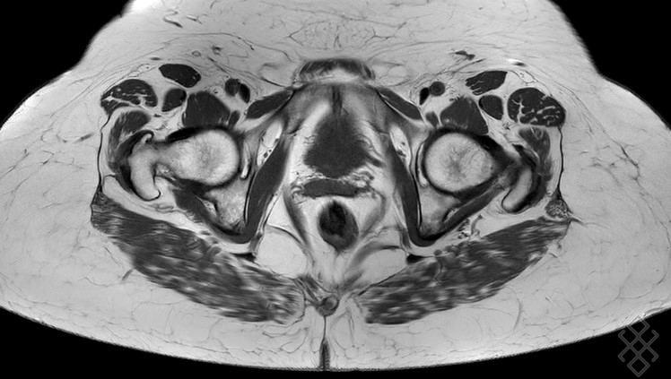 IRM du Bassin - Définition & Déroulement - Prise de rdv en ligne