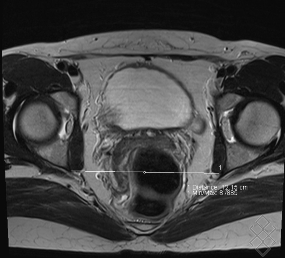Radiographie Pelvimétrie - Définition & Déroulement - Prise de rdv en ligne