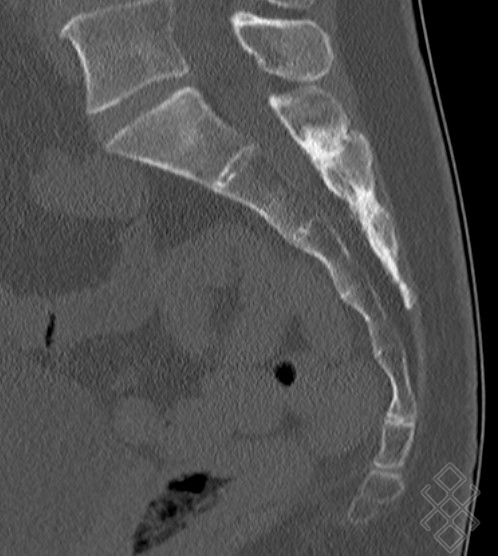 Scanner du Bassin - Définition & Déroulement - Prise de rdv en ligne