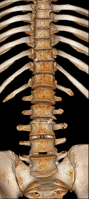 Scanner du Rachis dorsal - Définition & Déroulement - Prise de rdv en ligne