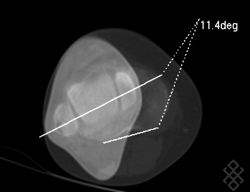 Scanner du Genou - Définition & Déroulement - Prise de rdv en ligne