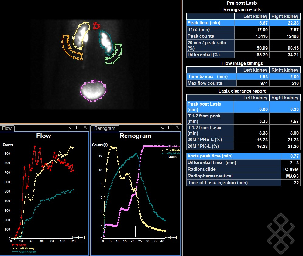 Scintigraphie Rénale - Définition & Déroulement - Prise de rdv en ligne