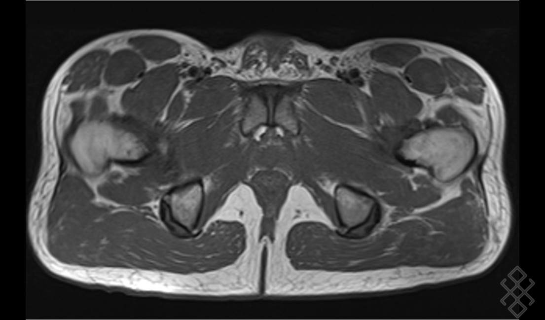 IRM du Bassin - Définition & Déroulement - Prise de rdv en ligne