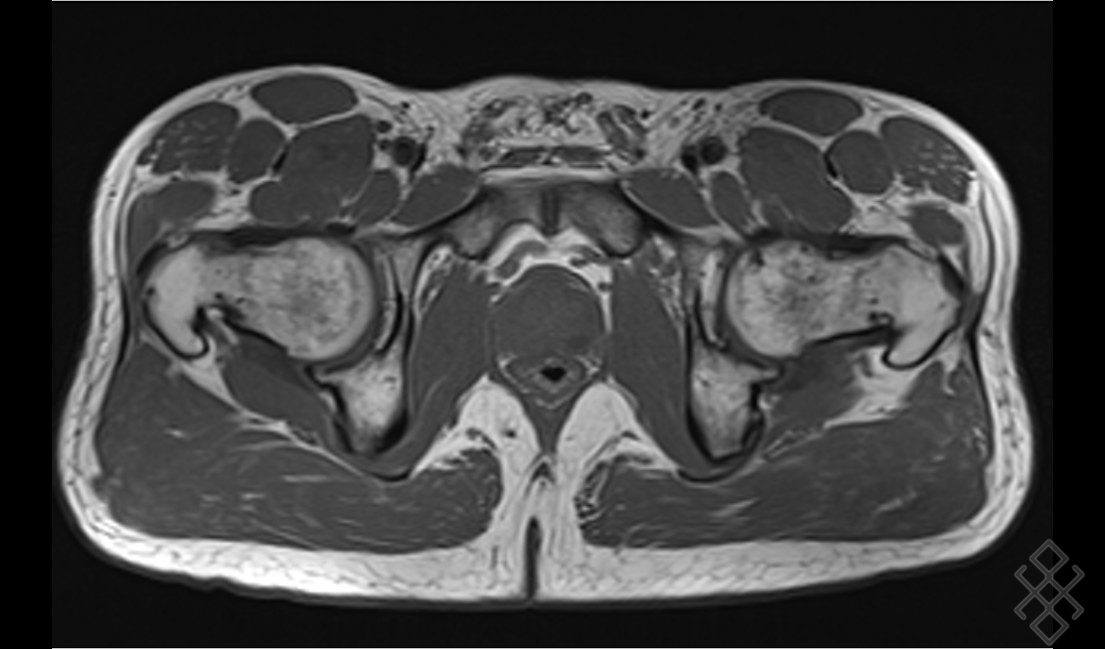 IRM du Bassin - Définition & Déroulement - Prise de rdv en ligne