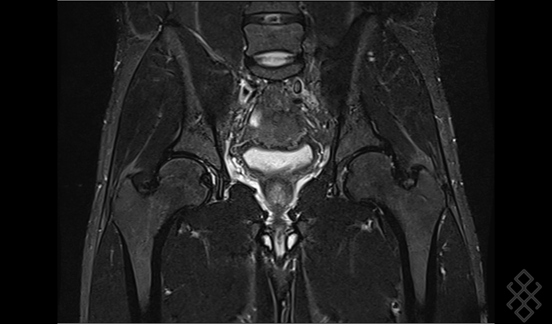 IRM du Bassin - Définition & Déroulement - Prise de rdv en ligne