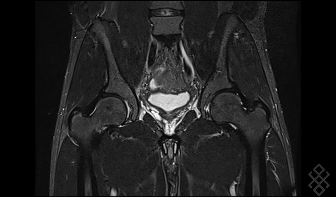 IRM du Bassin - Définition & Déroulement - Prise de rdv en ligne