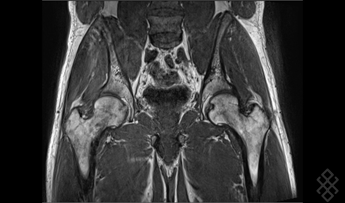 IRM du Bassin - Définition & Déroulement - Prise de rdv en ligne