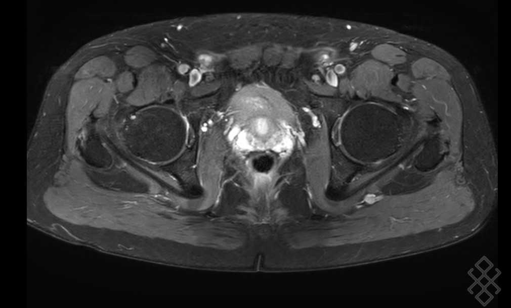 IRM du Bassin - Définition & Déroulement - Prise de rdv en ligne