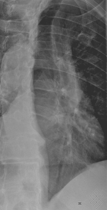 Radiographie du Sternum - Définition & Déroulement - Prise de rdv 100% ...
