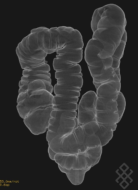 Coloscanner - Définition & Déroulement - Prise de rdv en ligne