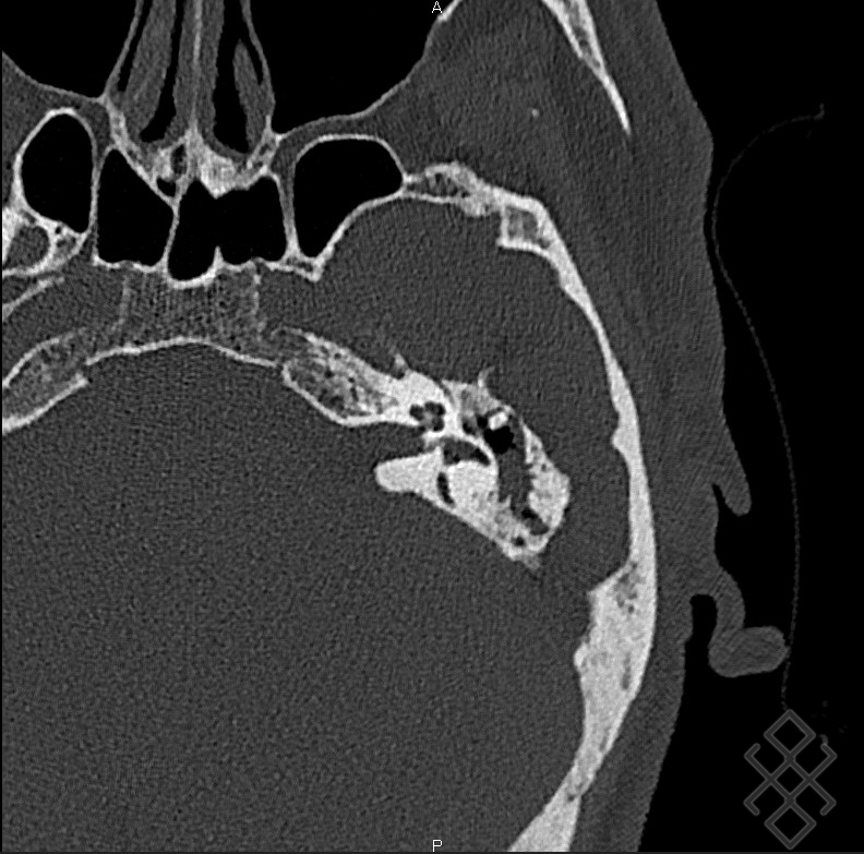 Scanner des Rochers - Définition & Déroulement - Prise de rdv 100% en ligne