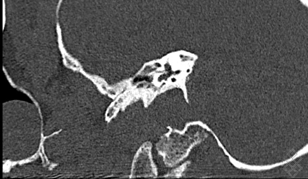 Scanner des Rochers - Définition & Déroulement - Prise de rdv en ligne