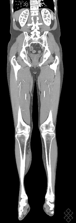 Scanner Corps Entier - Définition & Déroulement - Prise de rdv en ligne