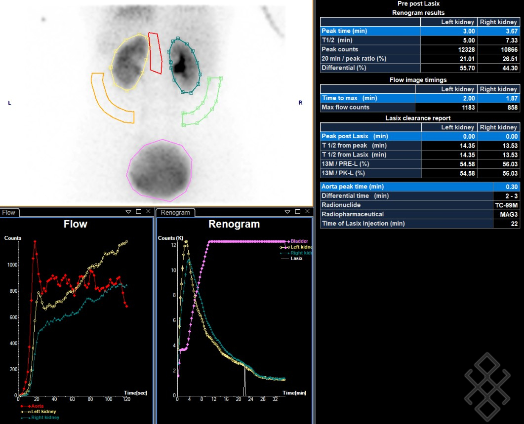 Scintigraphie Rénale - Définition & Déroulement - Prise de rdv en ligne