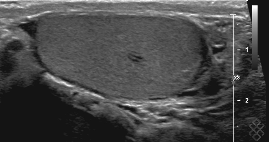 Échographie Testiculaire - Définition & Déroulement - Prise de rdv en ligne