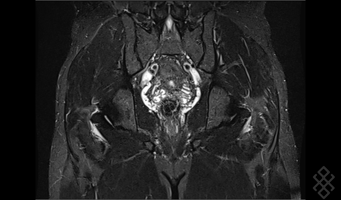 IRM du Bassin - Définition & Déroulement - Prise de rdv en ligne